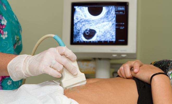 Durerea de ovare – ce înseamnă şi care sunt cauzele | Unica.ro