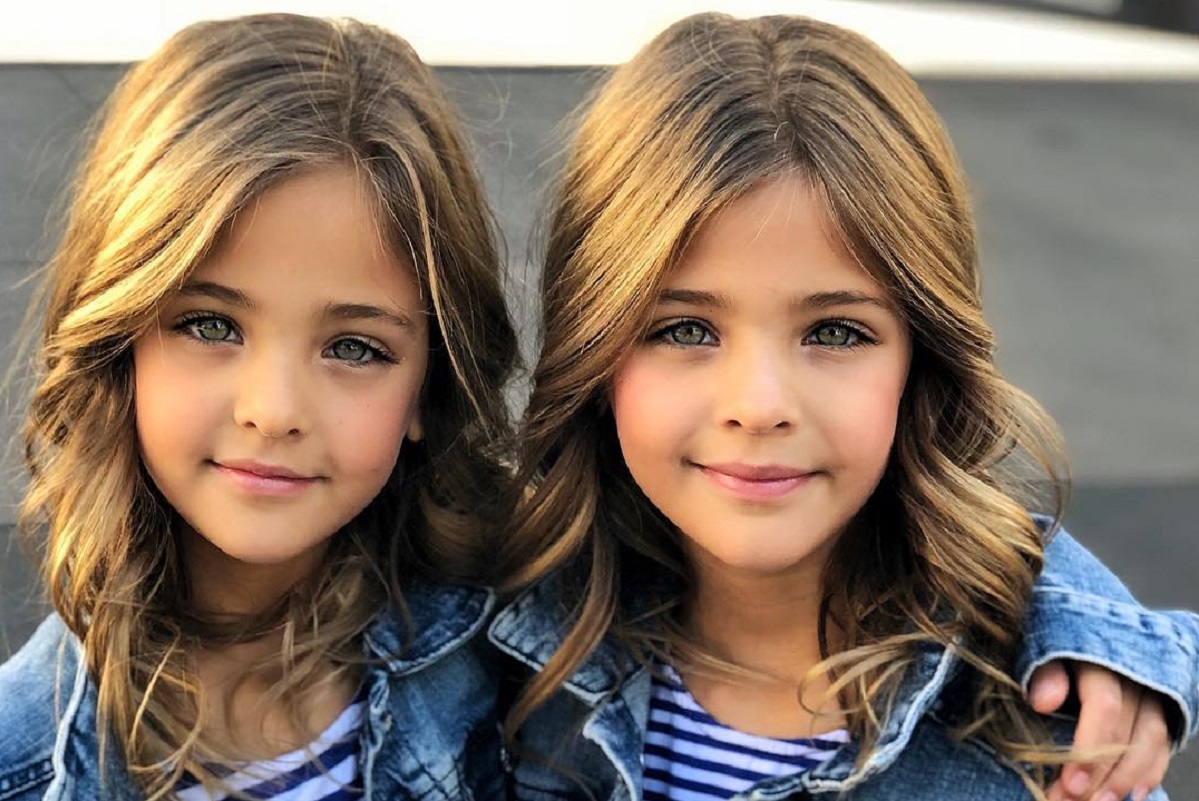 Au fost numite cele mai frumoase gemene din lume la 7 ani, dar acum ...