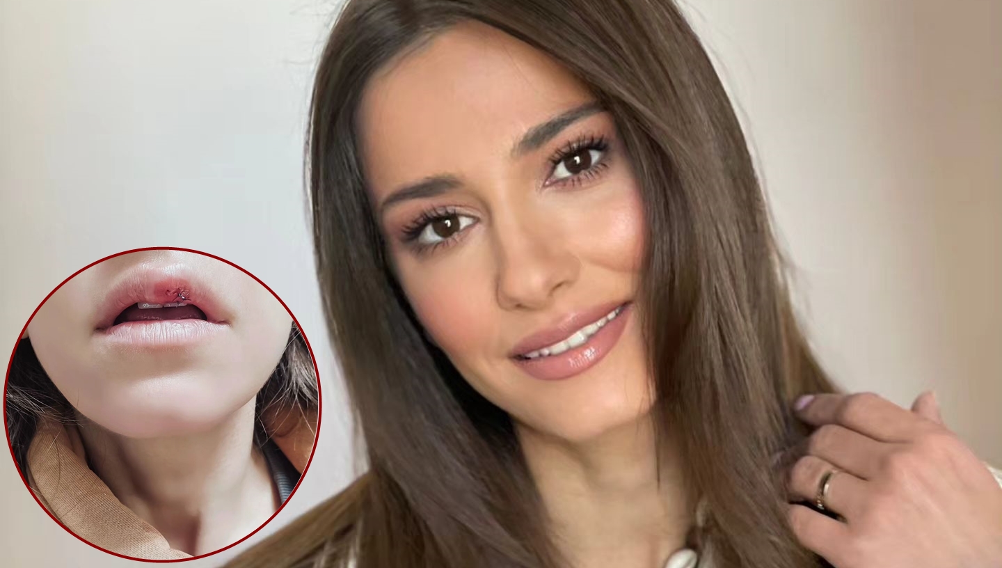 Dana Rogoz, la spital în urma unui „incident stupid”: „Am fost cusută ...